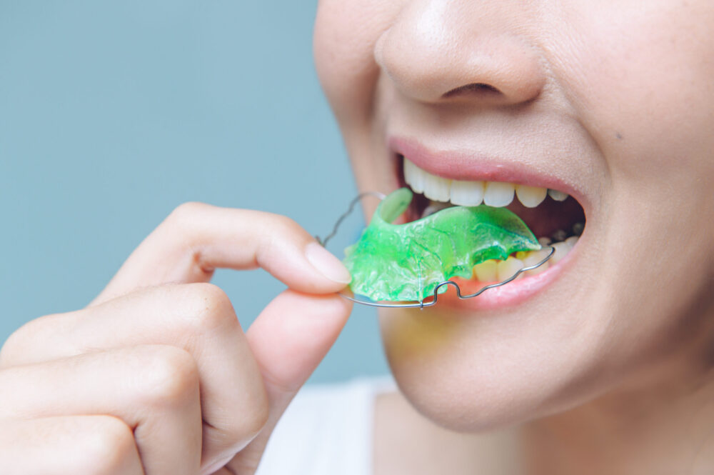 Retainers Davie | Grosman Orthodontics